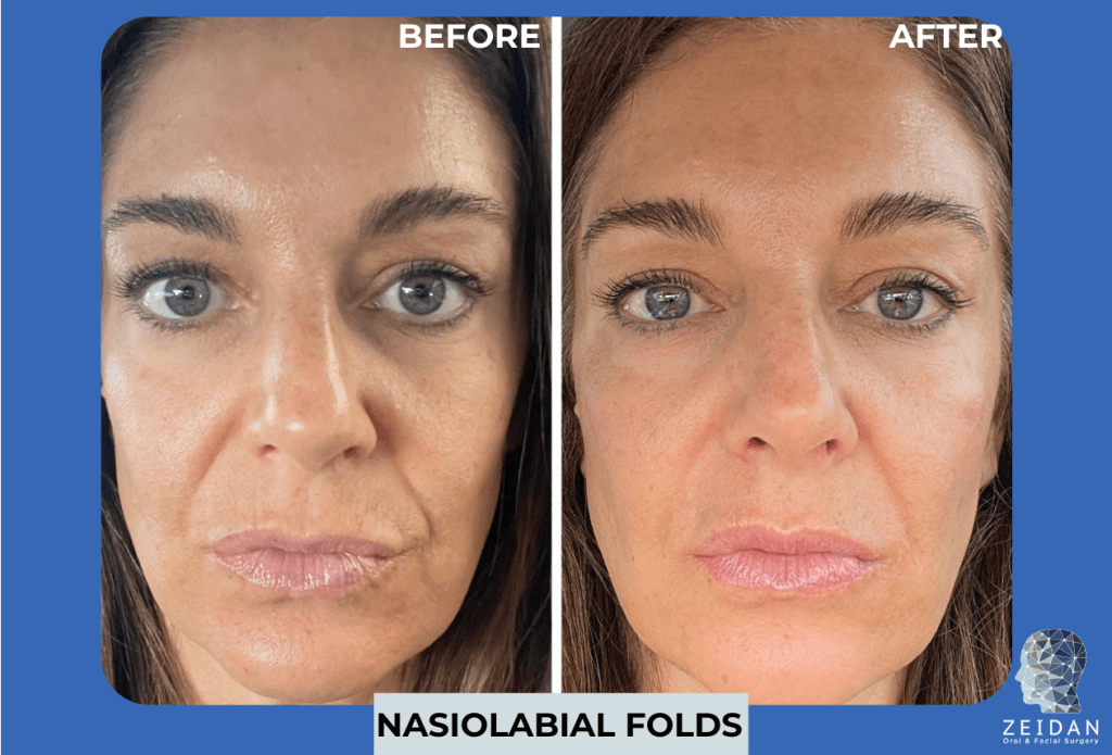 Oral and Maxillofacial Surgeon La Jolla CA | Oral Surgery