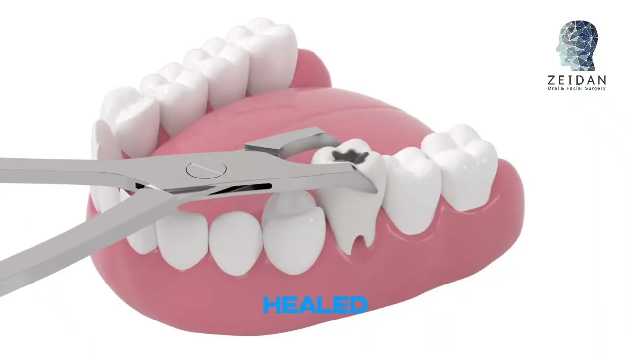 Emergency Oral Surgery Care La Jolla CA | San Diego Emergency Oral Surgery